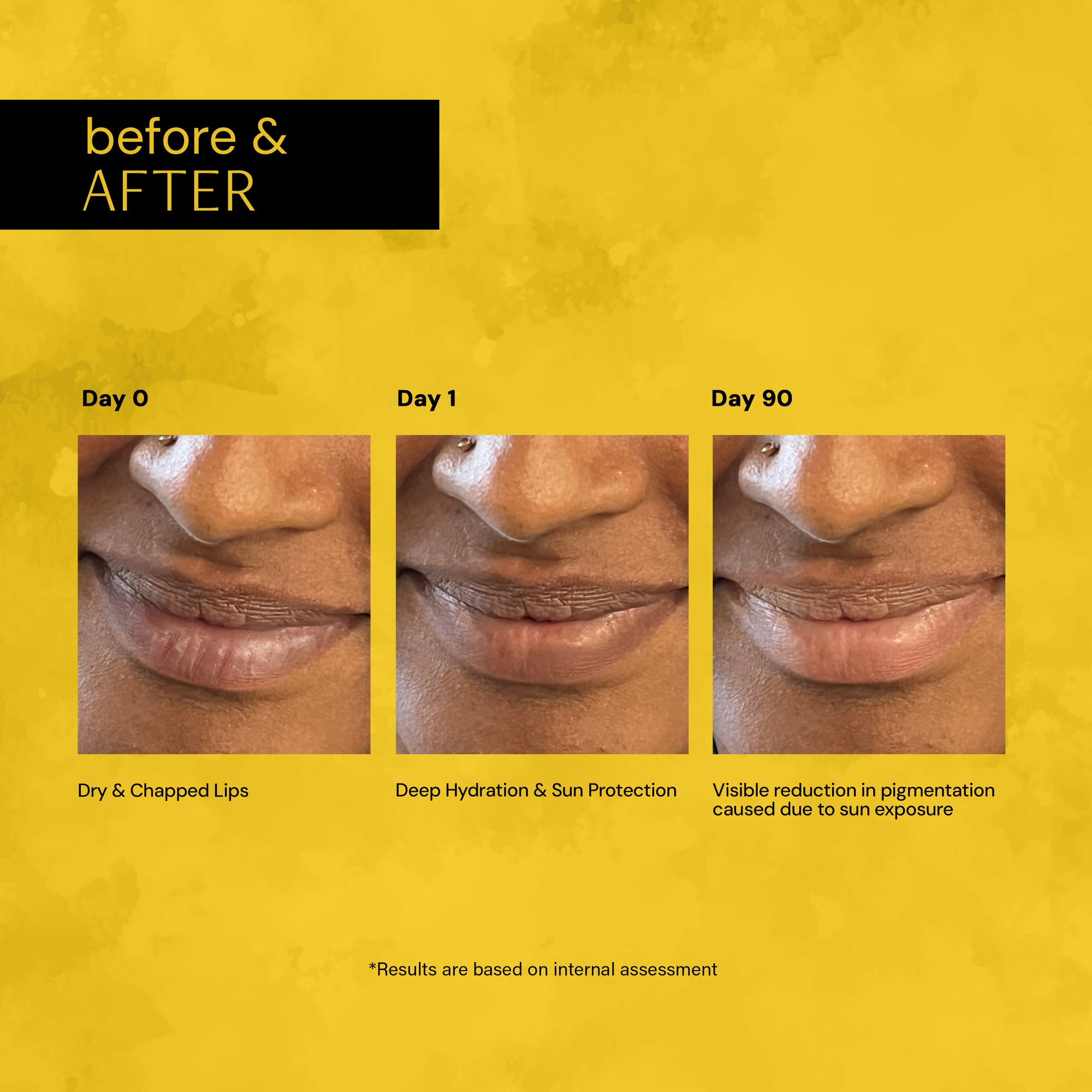 Buy Best Brightening Lip Balm for Dark Lips with SPF 30 at Deconstruct